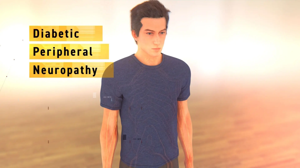 DIABETIC PERIPHERAL NEUROPATHY - Animation Studio & Video Production ...